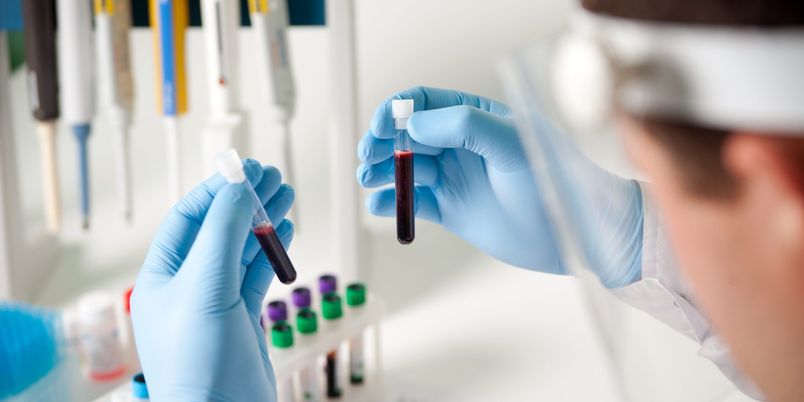 Superior safety profile for decitabine vs chemotherapy for older ...