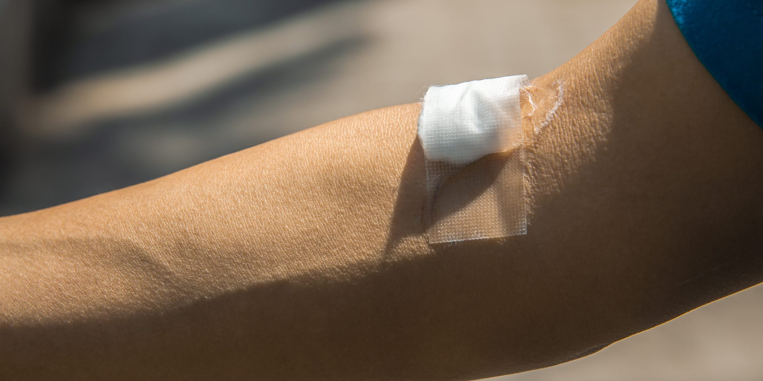 MCED blood test – a gamechanger for early cancer detection